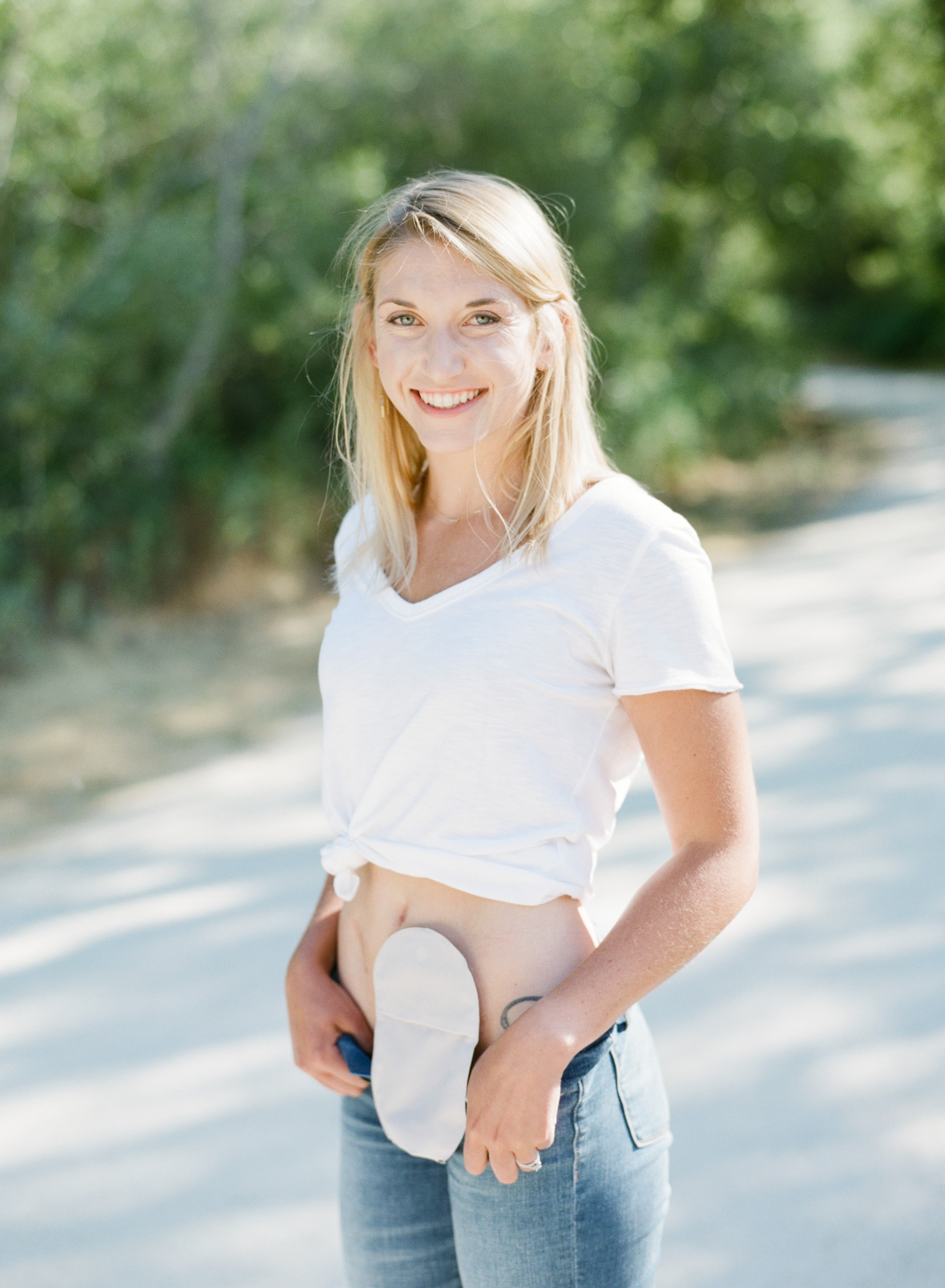 “So, You Have An Ostomy: A Look Into Your Future and How to Support a ...