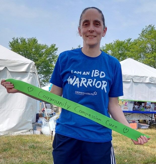 Wearable Devices and IBD: Hear one woman’s experience as a citizen ...